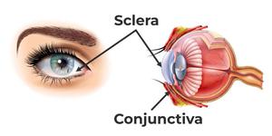 Difference Between Sclera And Conjunctiva - GeeksforGeeks