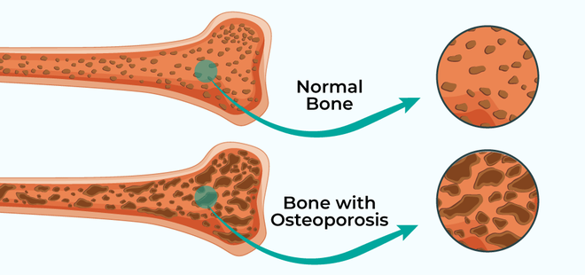 Disorders of the Muscular and Skeletal System