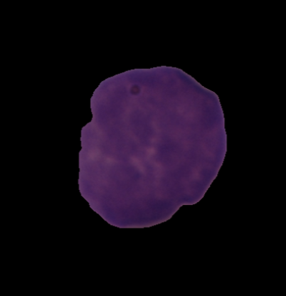 Leukaemia Cell Classification For Paediatric Cancer Diagnosis ...