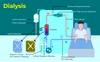 Dialysis - Definition, Procedure, Types, Principle and Side Effects ...