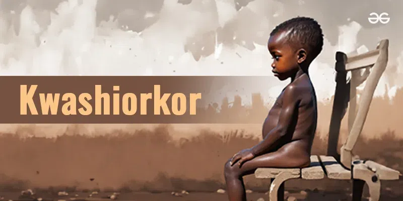 Kwashiorkor - An Overview - GeeksforGeeks