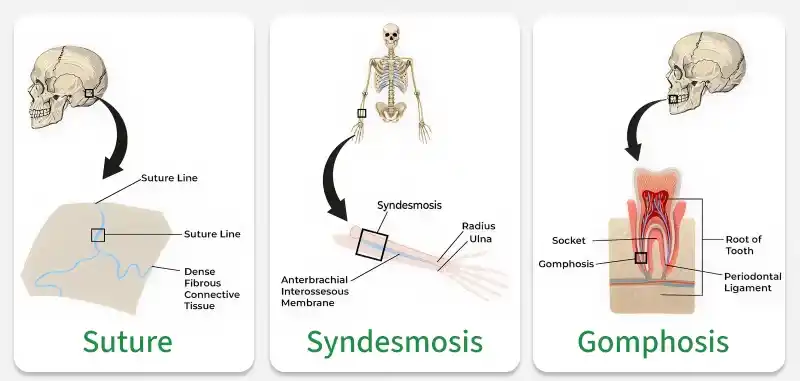 Types of Joints - GeeksforGeeks